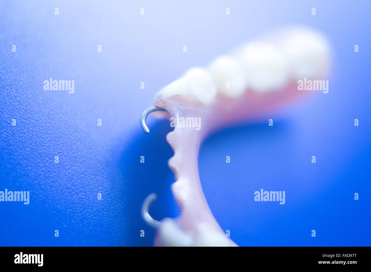 Removable partial denture metal and plastic dental false teeth ...
