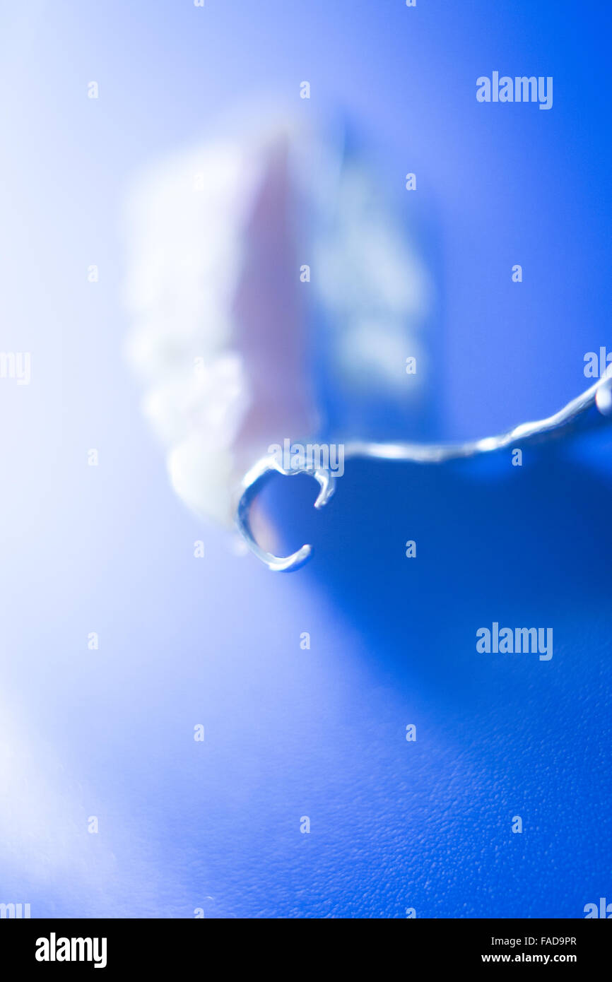 Removable partial denture metal and plastic dental false teeth ...