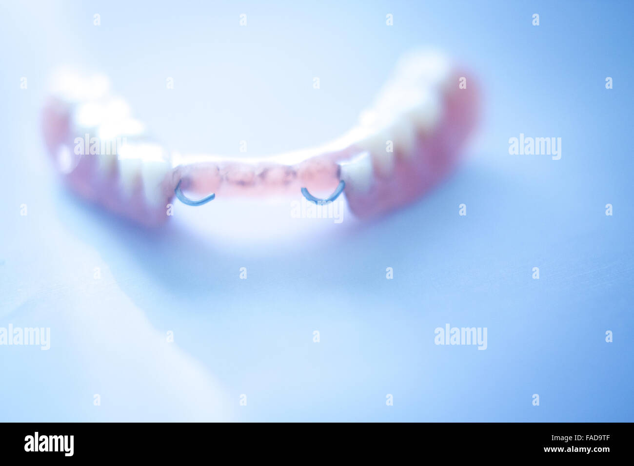 Removable partial denture metal and plastic dental false teeth ...