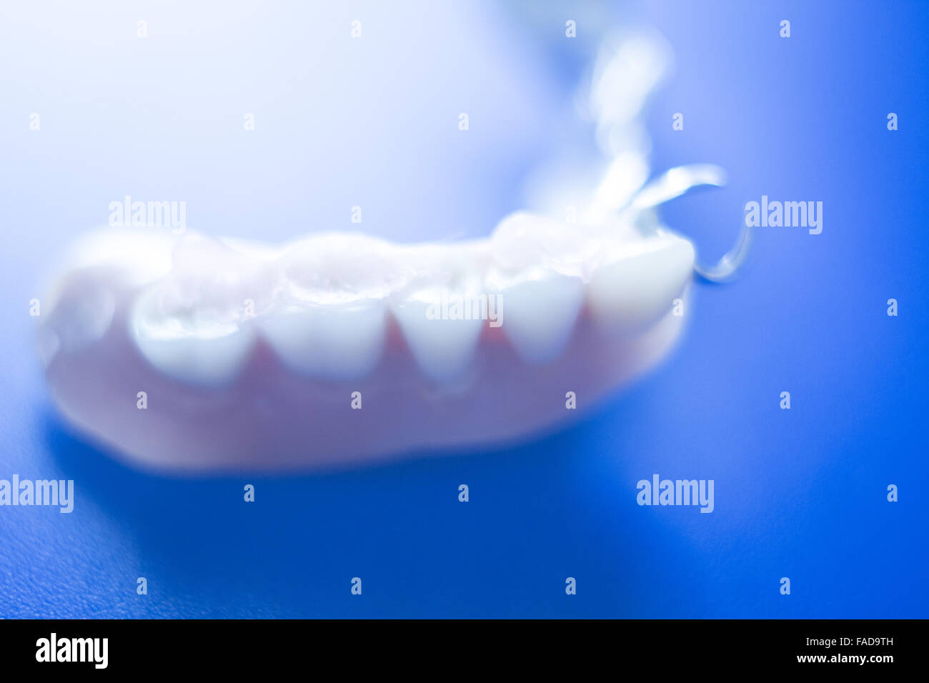 Removable partial denture metal and plastic dental false teeth ...