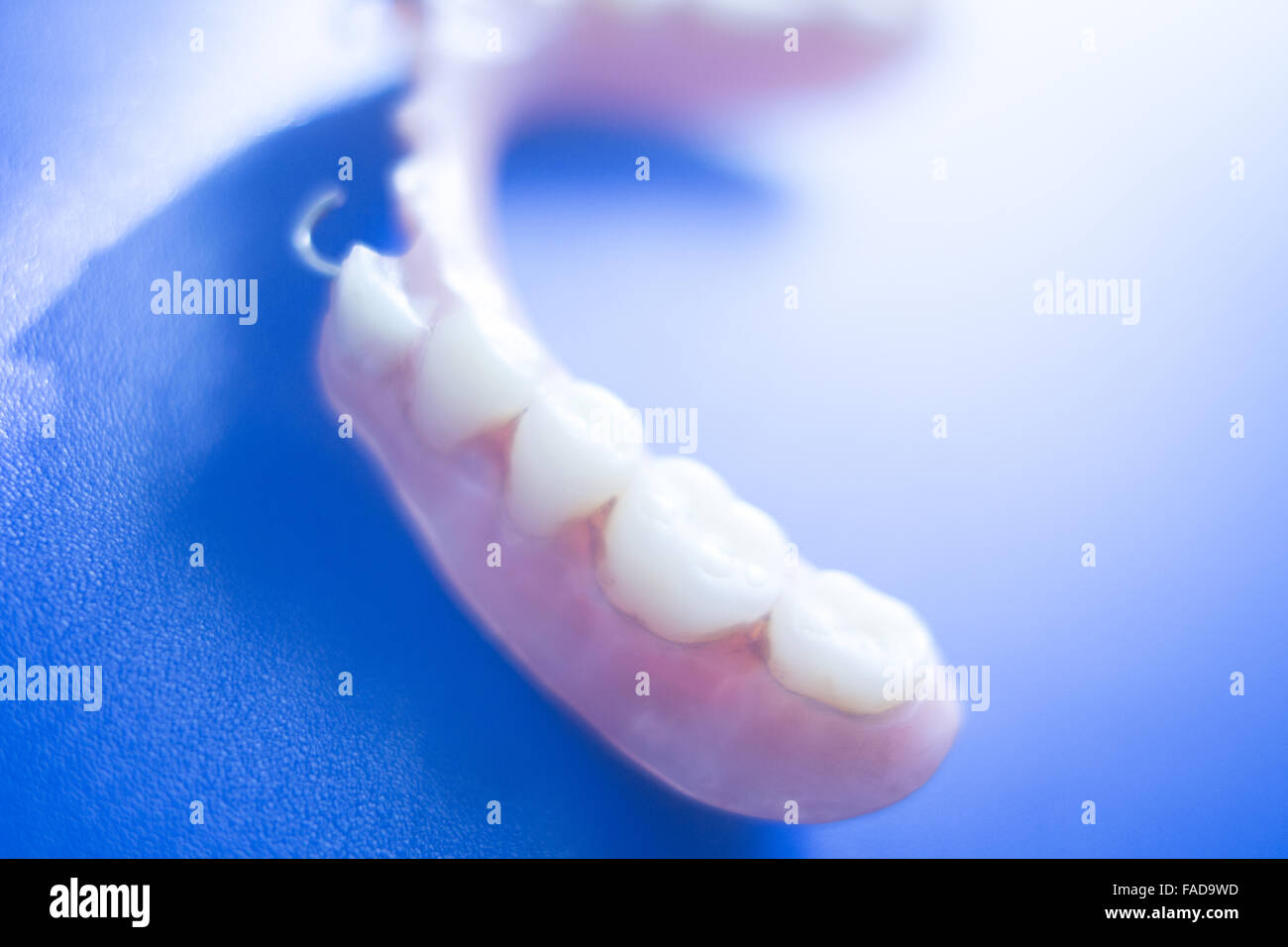 Removable partial denture metal and plastic dental false teeth ...