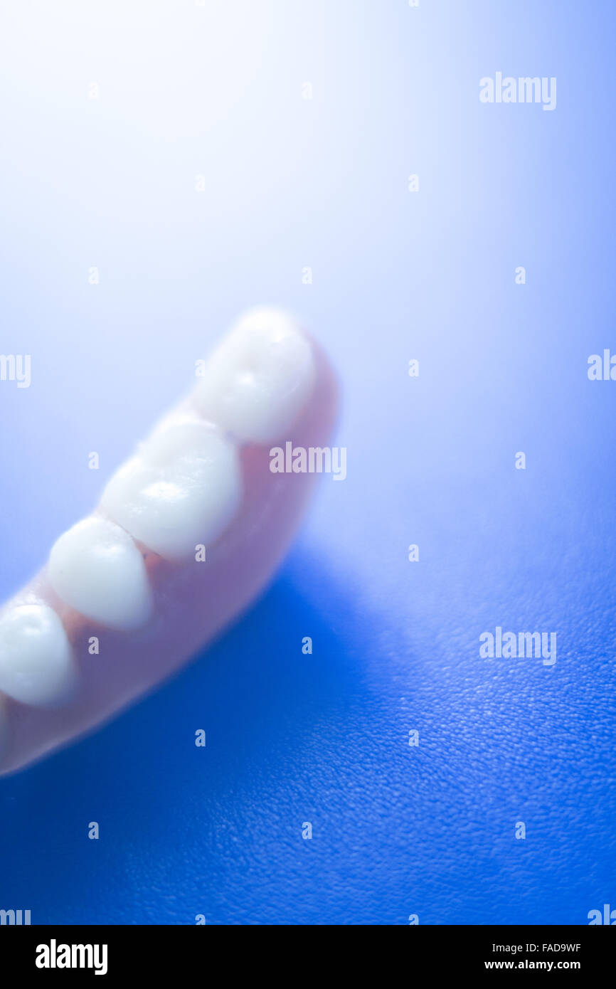 Removable partial denture metal and plastic dental false teeth ...