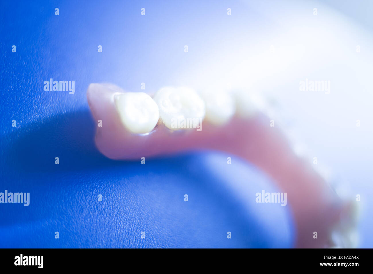 Removable partial denture metal and plastic dental false teeth ...