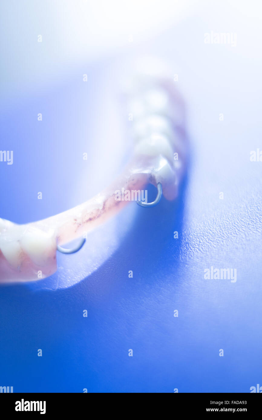 Removable partial denture metal and plastic dental false teeth ...