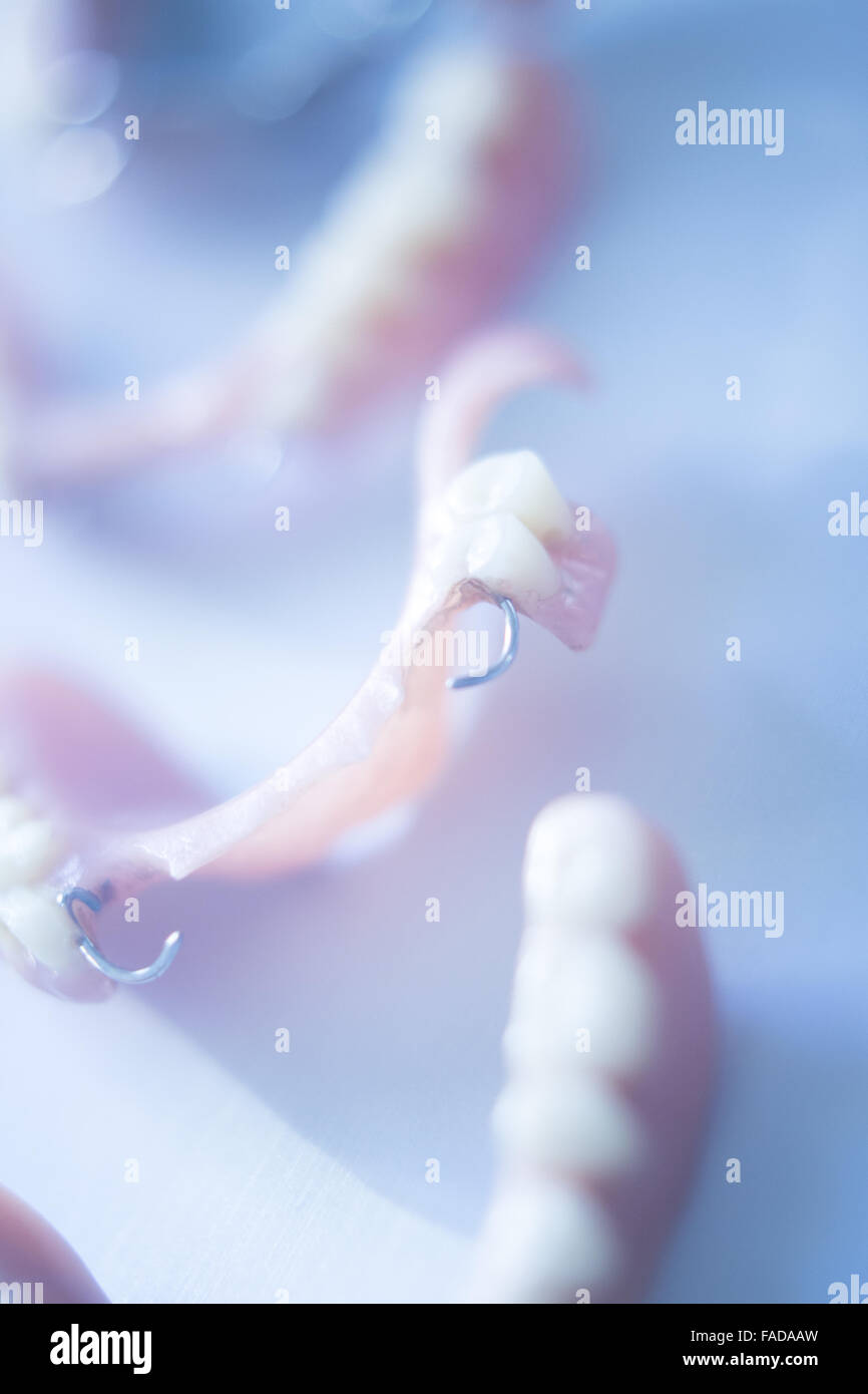 Removable partial denture metal and plastic dental false teeth ...