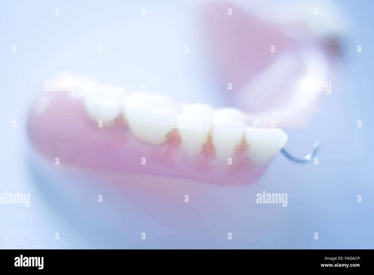 Removable partial denture metal and plastic dental false teeth ...