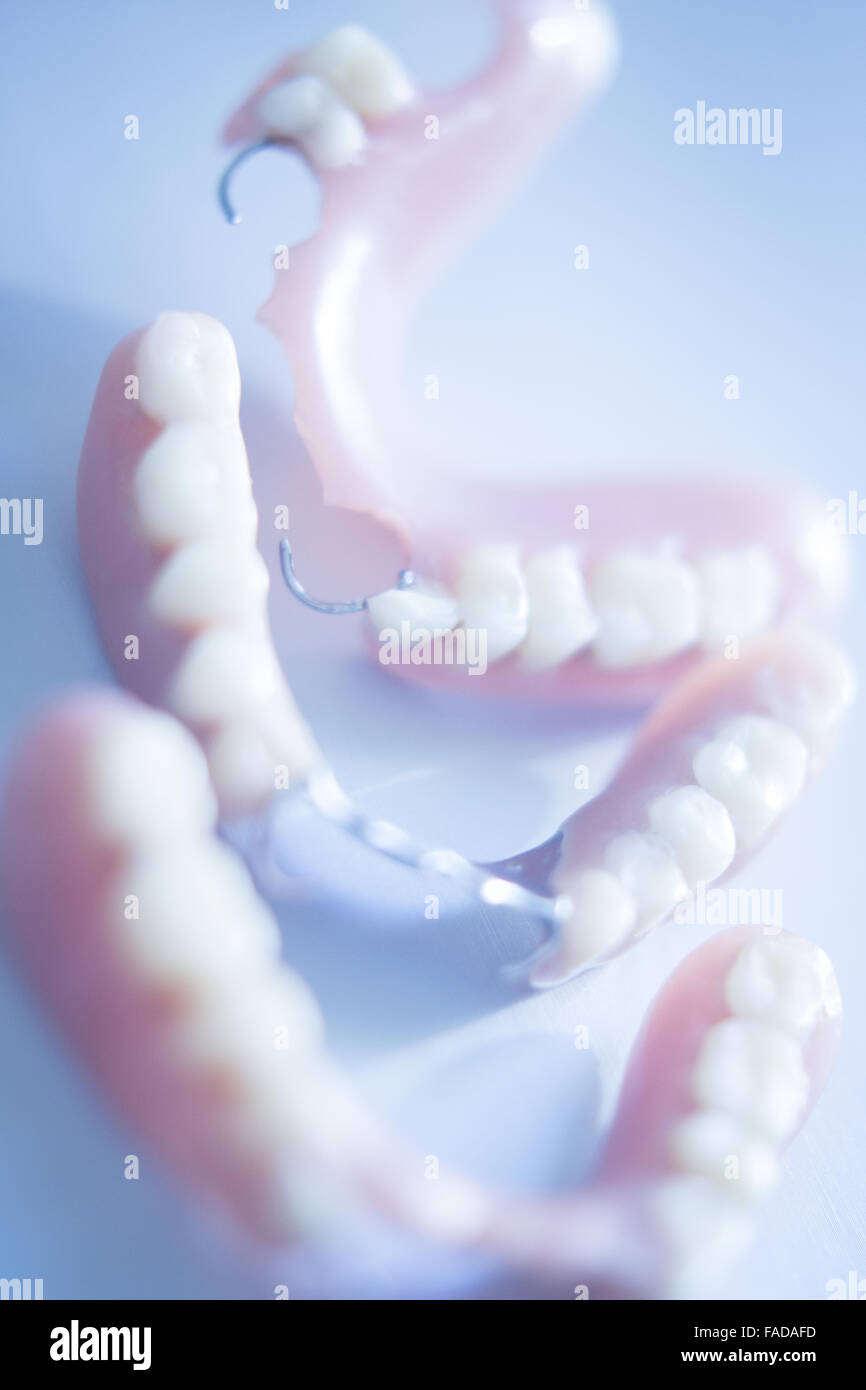 Removable partial denture metal and plastic dental false teeth ...