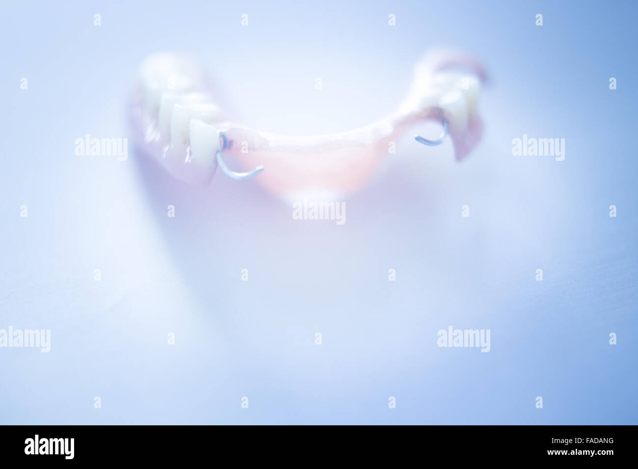 Removable partial denture metal and plastic dental false teeth ...