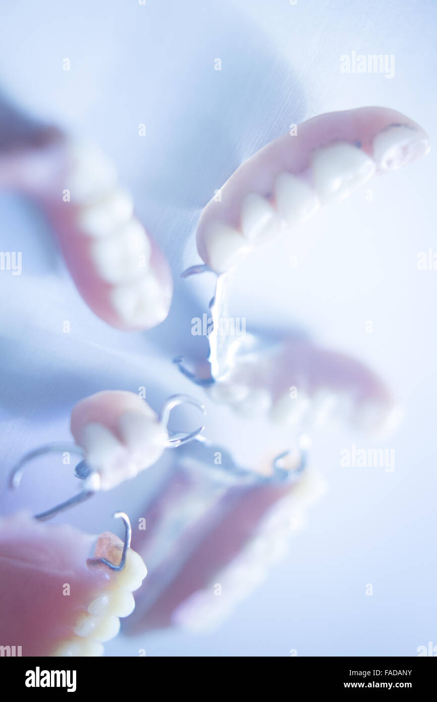 Removable partial denture metal and plastic dental false teeth ...