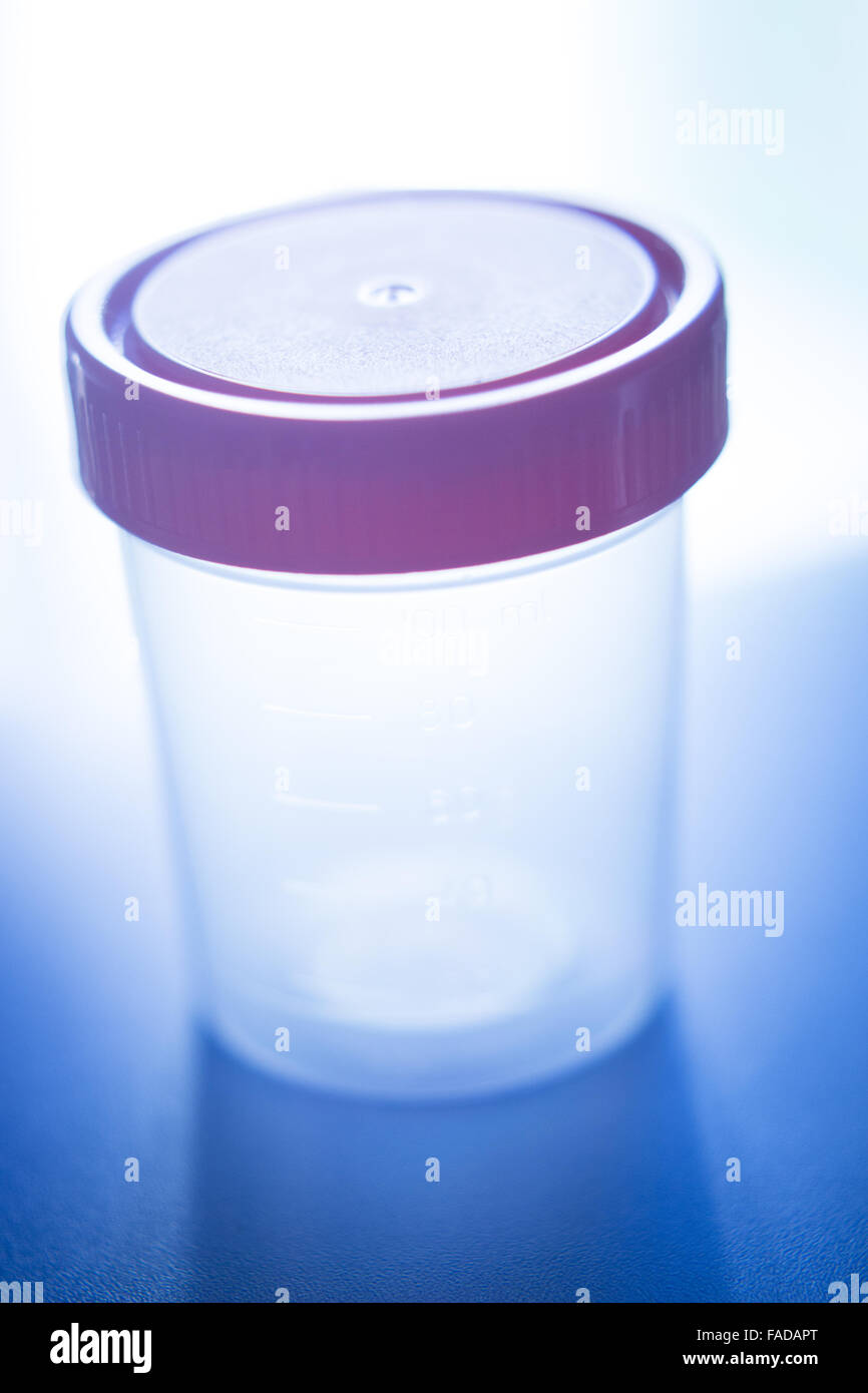 Urine sample plastic beaker for urine testing for drugs and illness ...