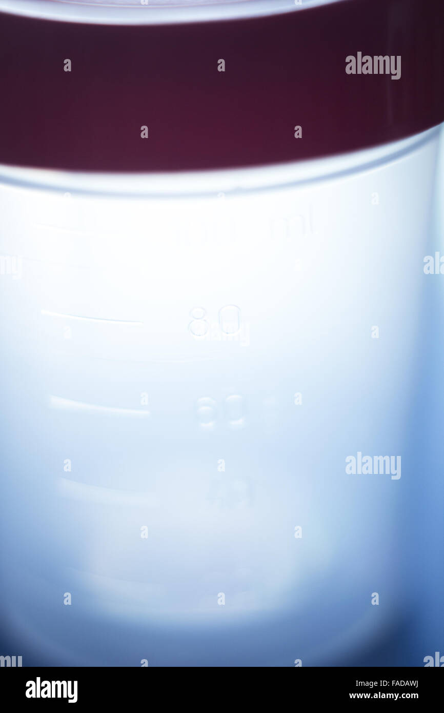 Urine sample plastic beaker for urine testing for drugs and illness ...