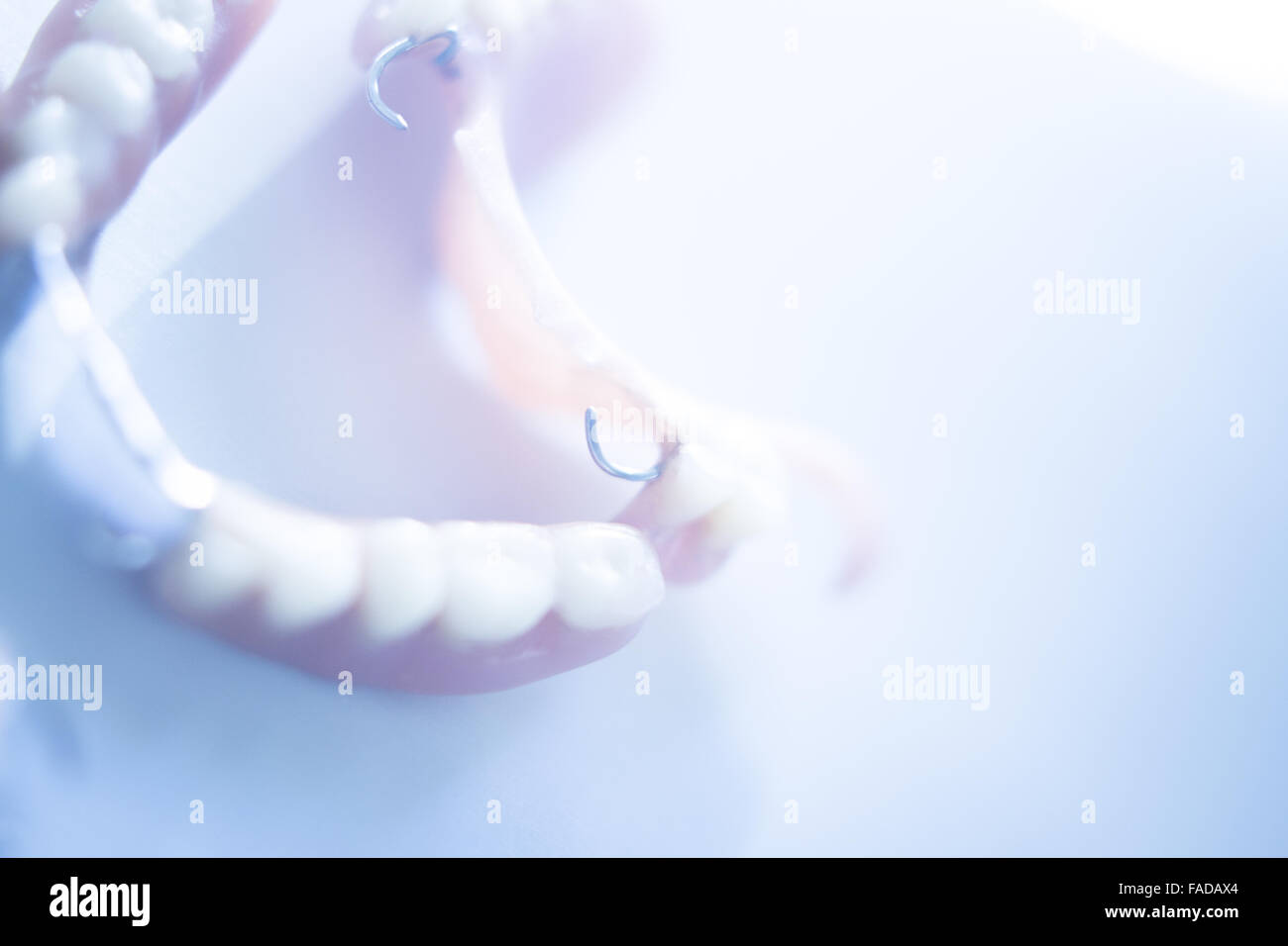 Removable partial denture metal and plastic dental false teeth ...