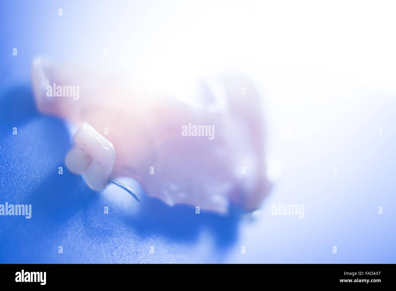 Removable partial denture metal and plastic dental false teeth ...