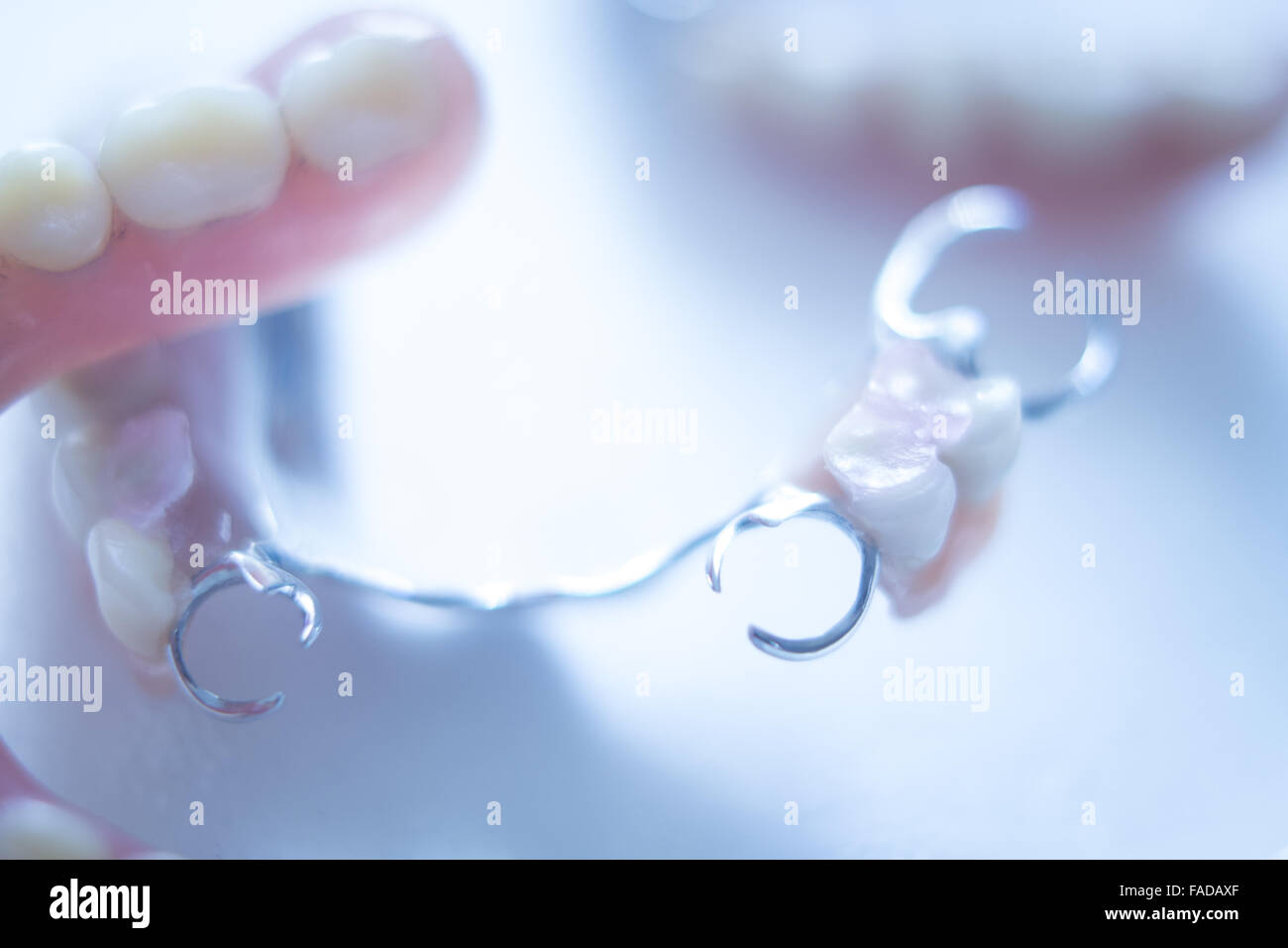 Removable partial denture metal and plastic dental false teeth ...