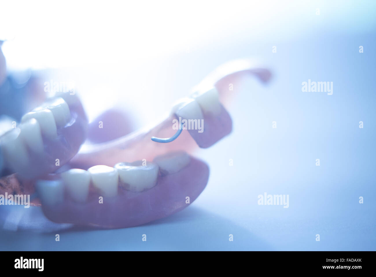 Removable partial denture metal and plastic dental false teeth ...