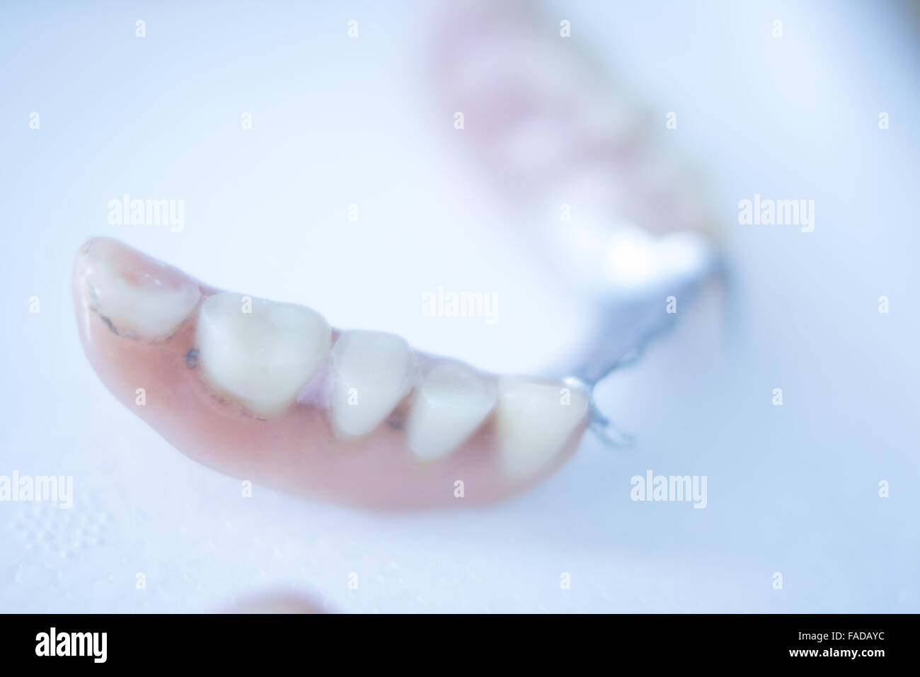 Removable partial denture metal and plastic dental false teeth ...