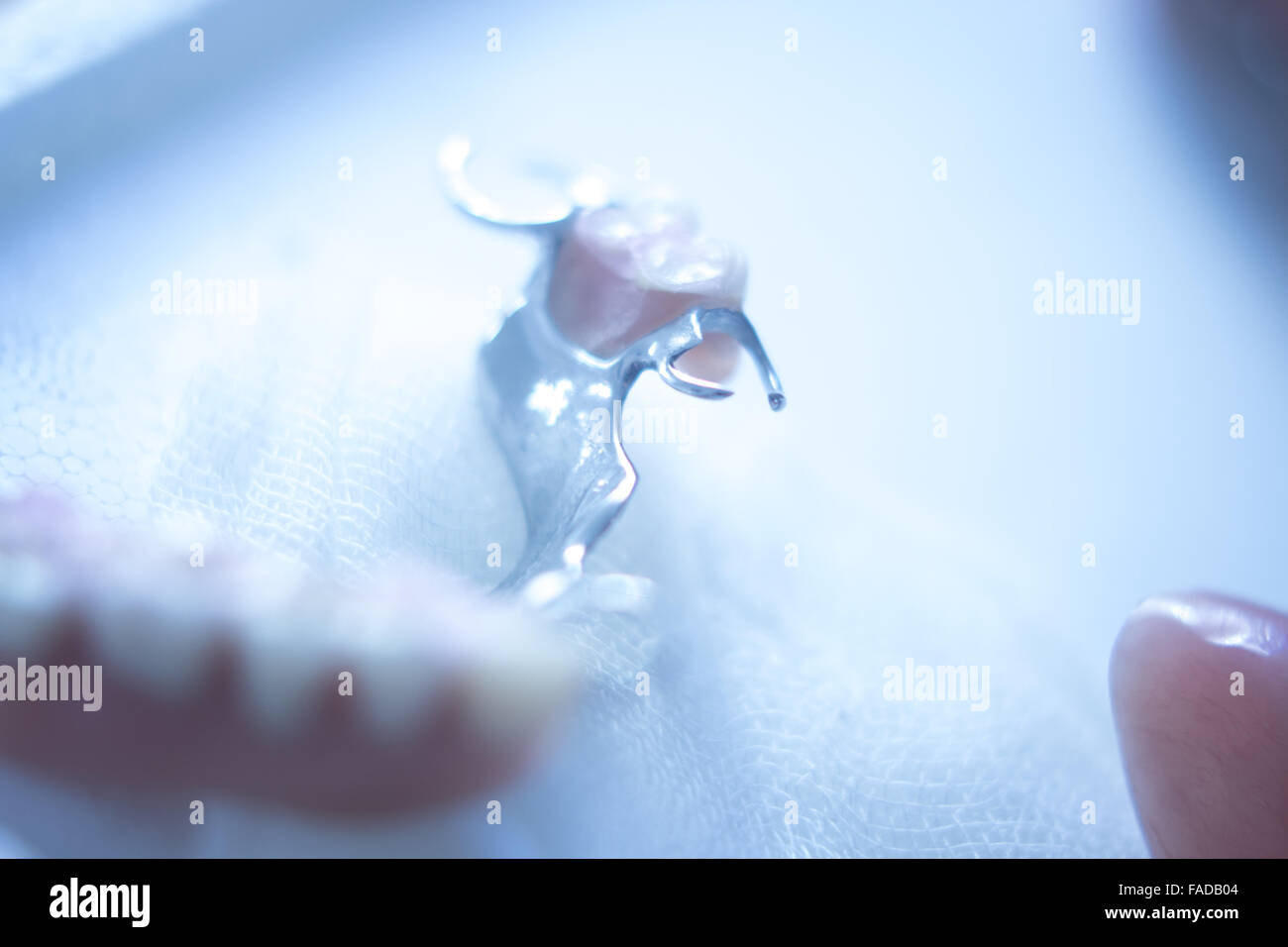 Removable partial denture metal and plastic dental false teeth ...