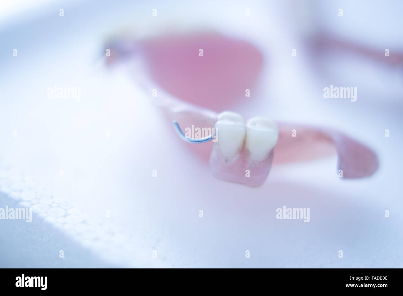 Removable partial denture metal and plastic dental false teeth ...