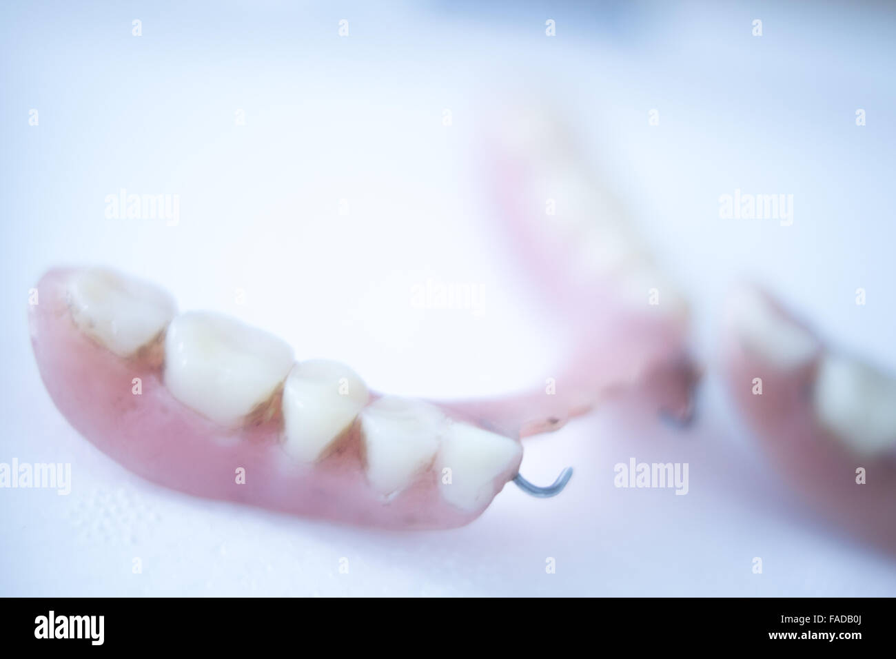 Removable partial denture metal and plastic dental false teeth ...