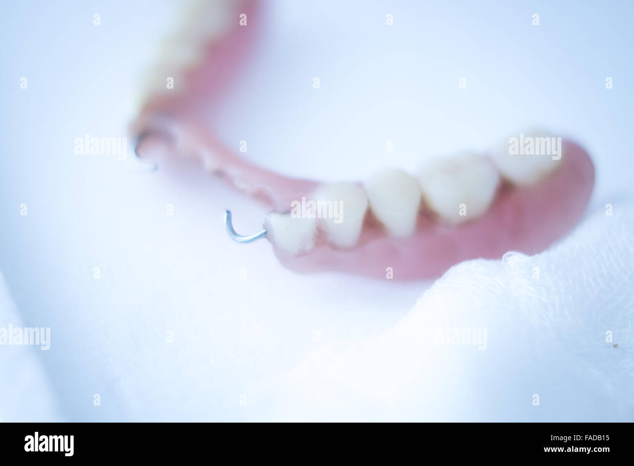 Removable partial denture metal and plastic dental false teeth ...