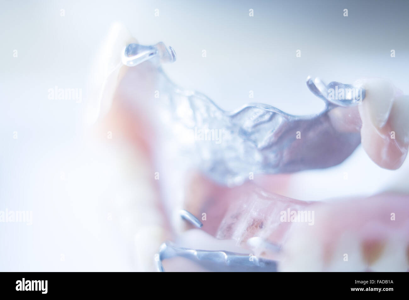 Removable partial denture metal and plastic dental false teeth ...