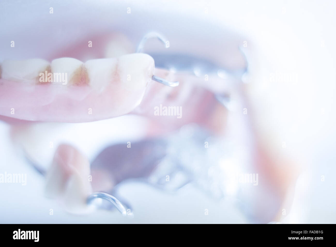 Removable partial denture metal and plastic dental false teeth ...