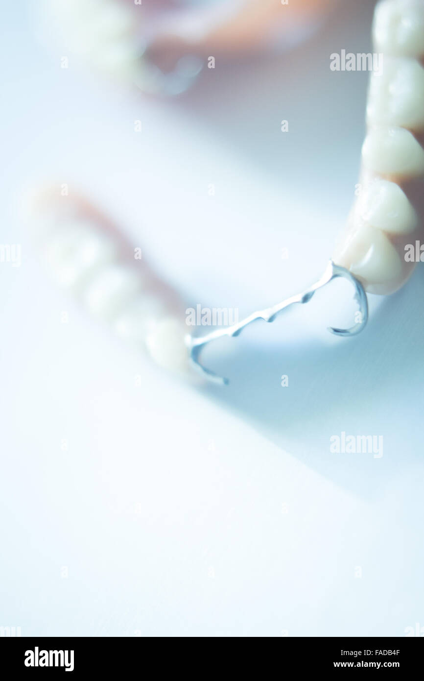 Removable partial denture metal and plastic dental false teeth ...