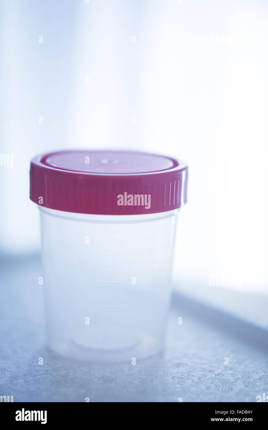 Urine sample plastic beaker for urine testing for drugs and illness ...