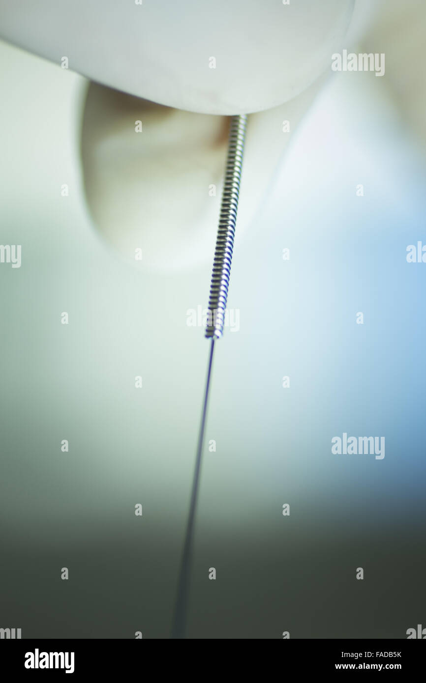 Acupuncture needle used for dry needling rehabilitation medical ...
