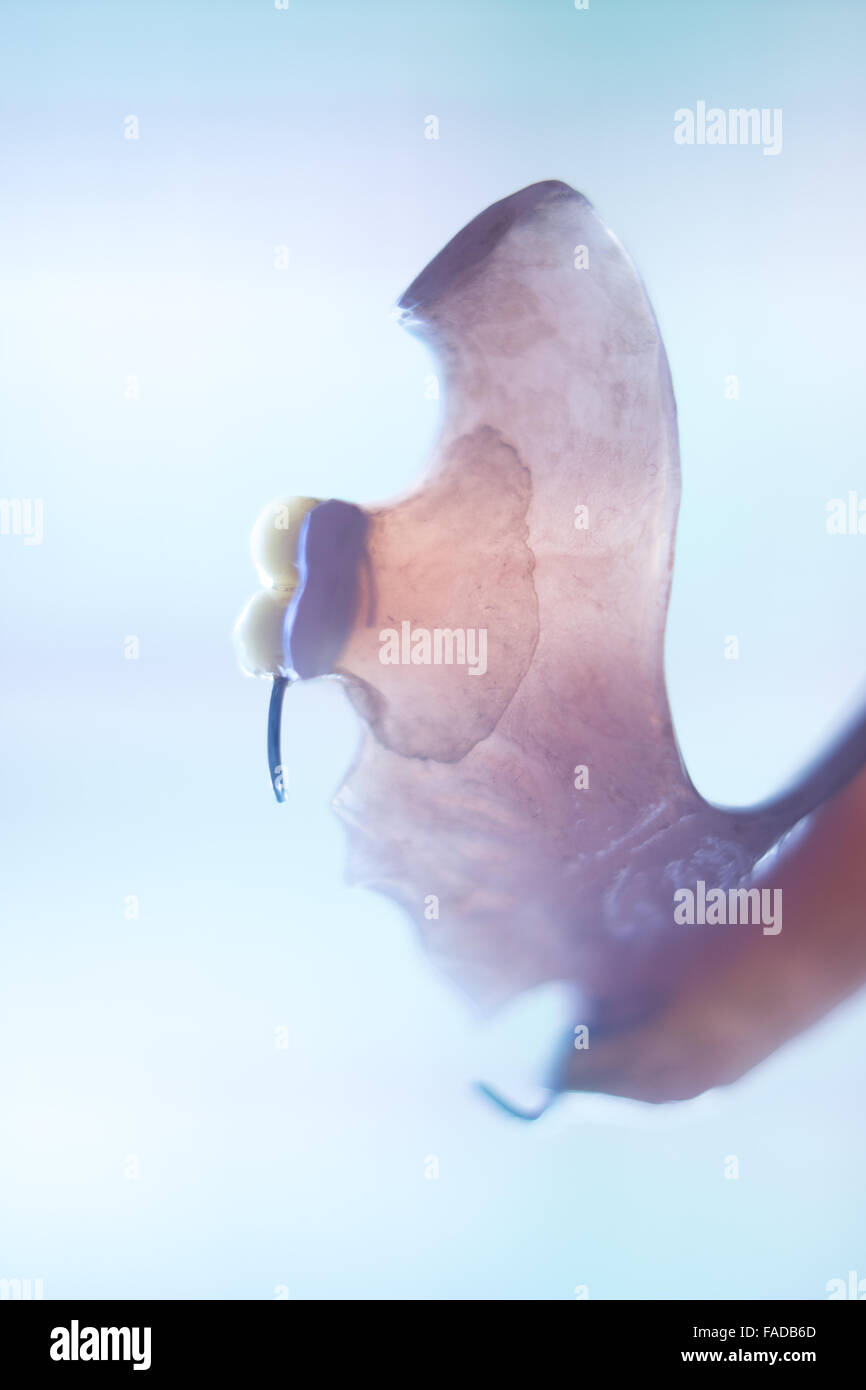 Removable partial denture metal and plastic dental false teeth ...