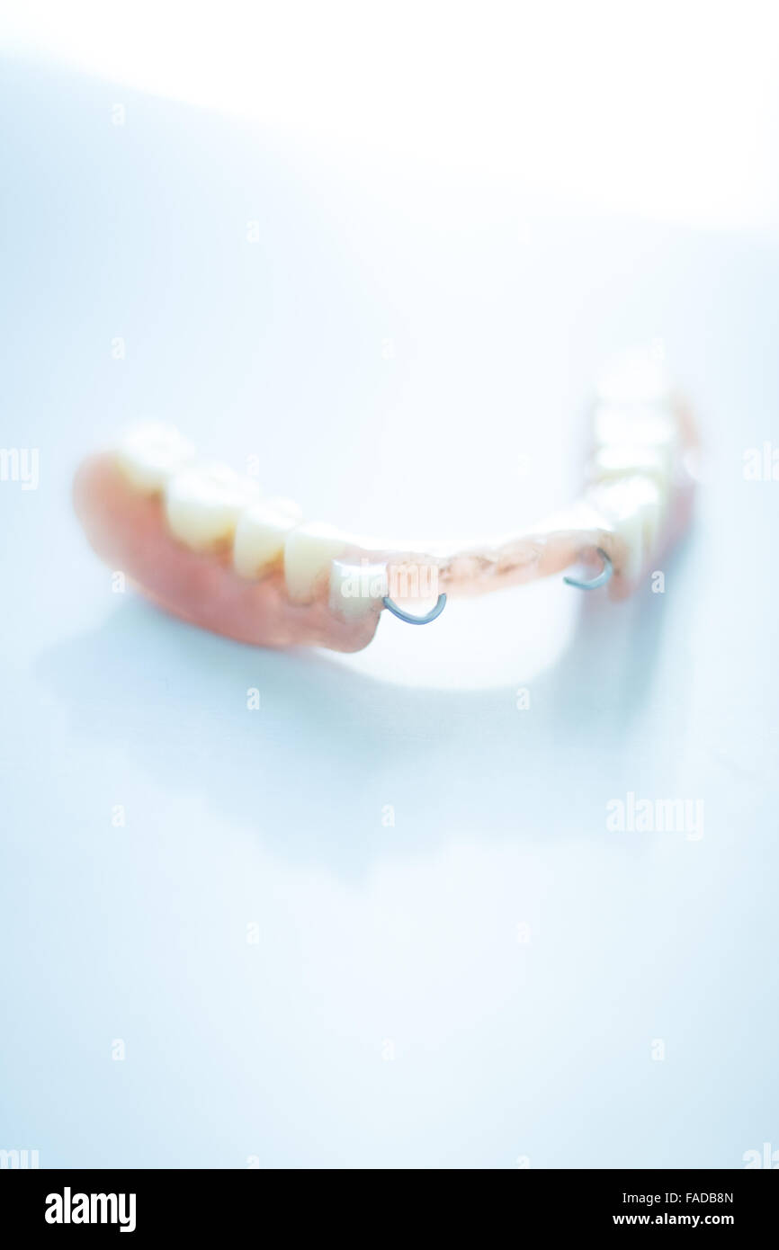 Removable partial denture metal and plastic dental false teeth ...