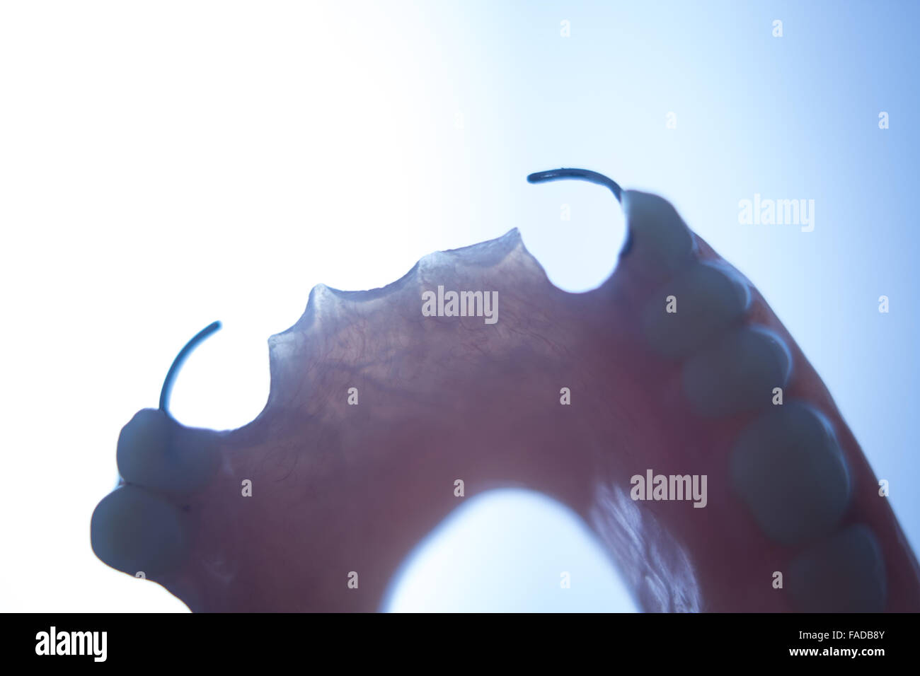 Removable partial denture metal and plastic dental false teeth ...