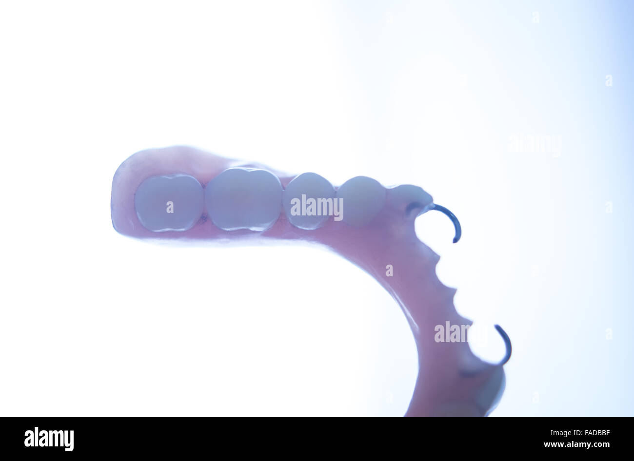 Removable partial denture metal and plastic dental false teeth ...