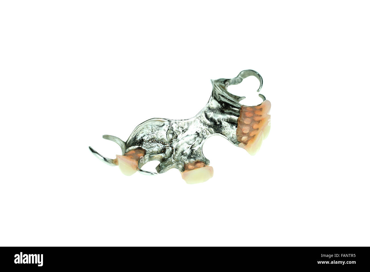 Removable partial denture for upper teeth isolated on white background ...