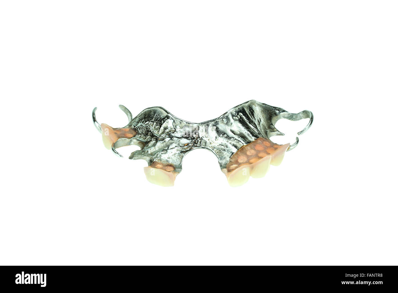 Removable partial denture for upper teeth isolated on white background ...