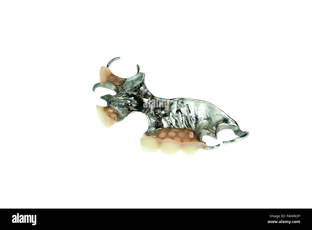 Removable partial denture for upper teeth isolated on white background ...