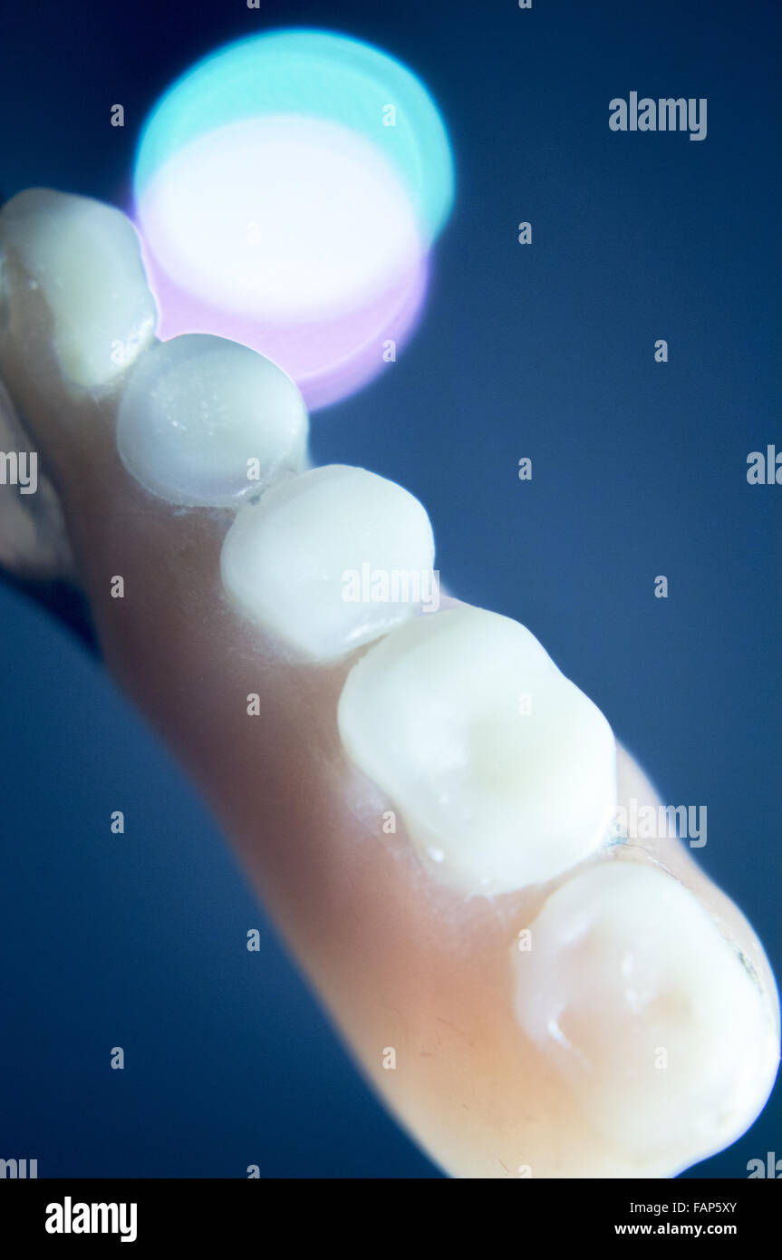 Removable partial denture metal and plastic dental false teeth ...