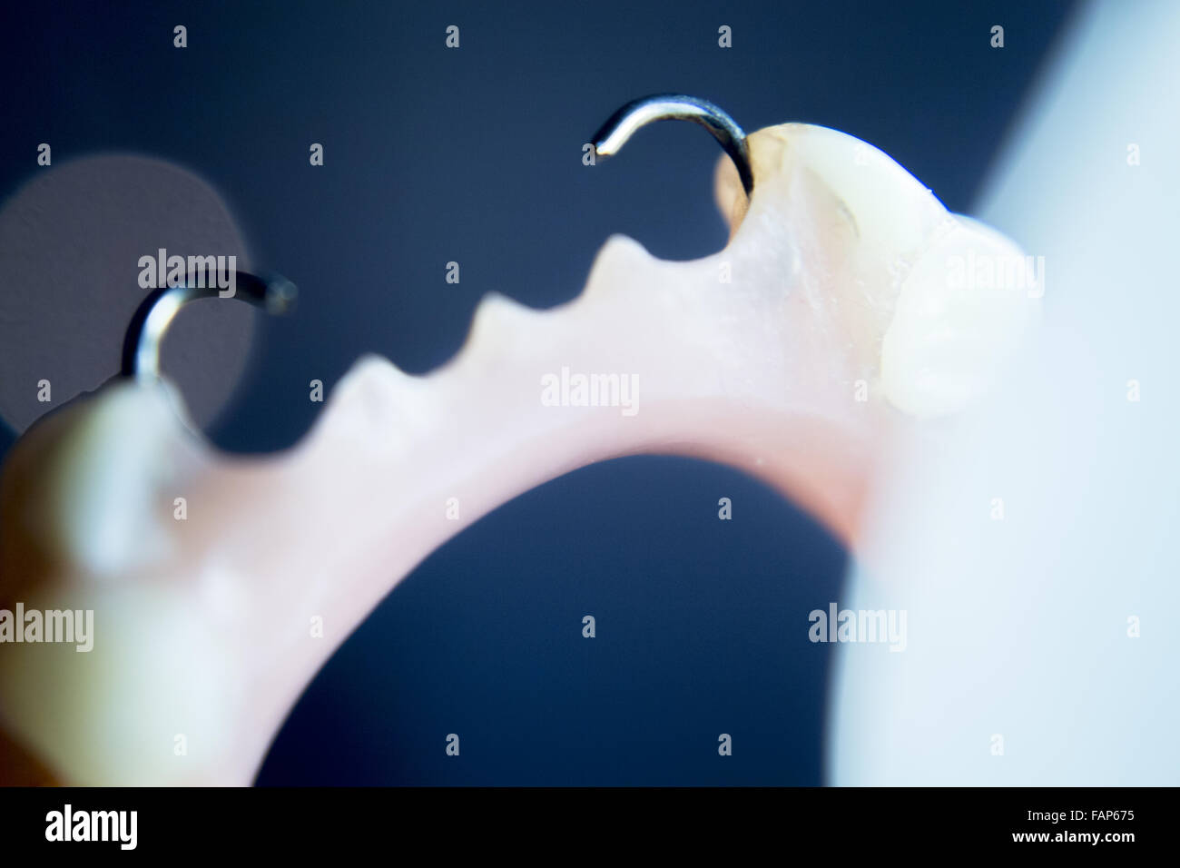 Removable partial denture metal and plastic dental false teeth ...