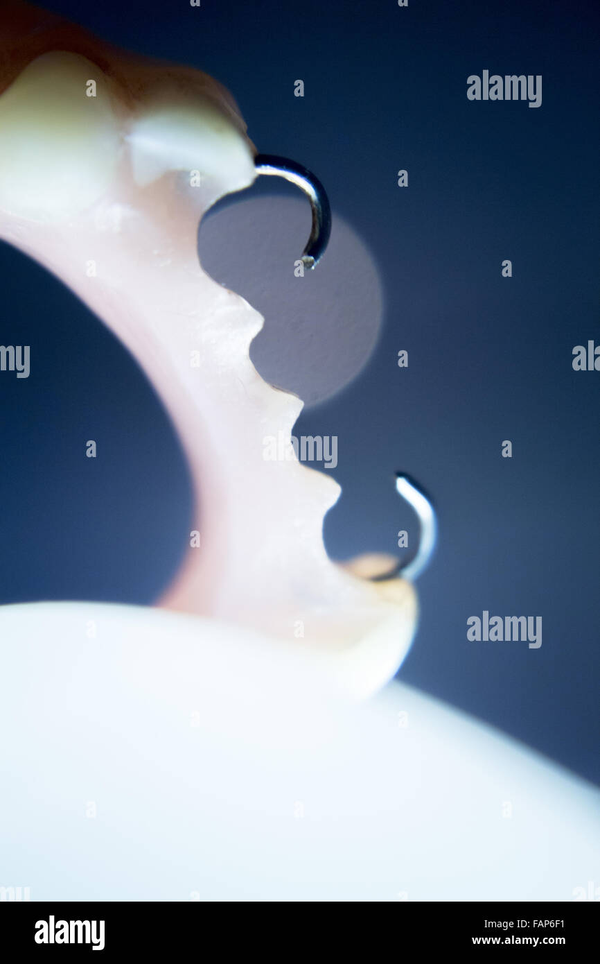 Removable partial denture metal and plastic dental false teeth ...