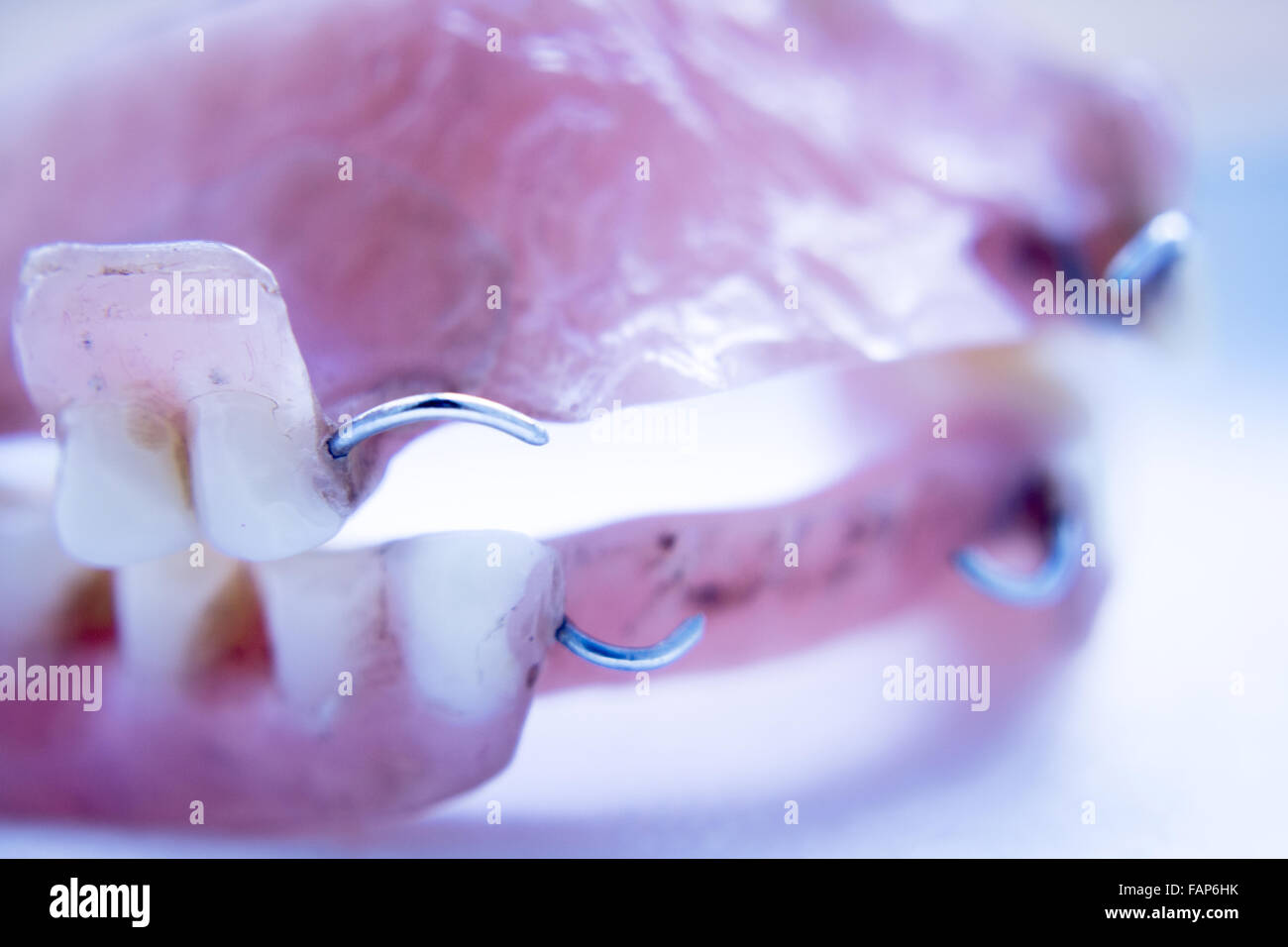 Removable partial denture metal and plastic dental false teeth ...