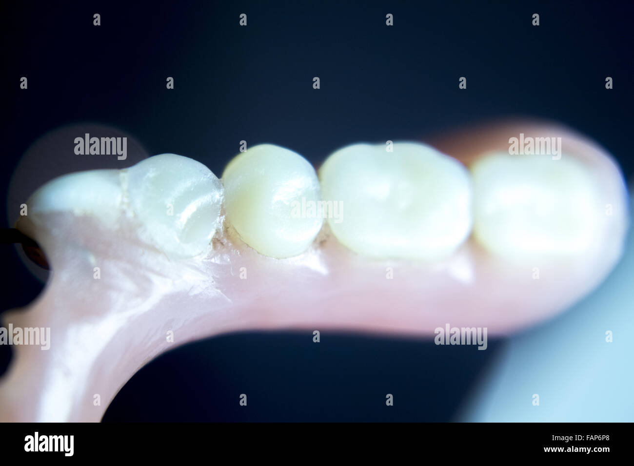 Removable partial denture metal and plastic dental false teeth ...