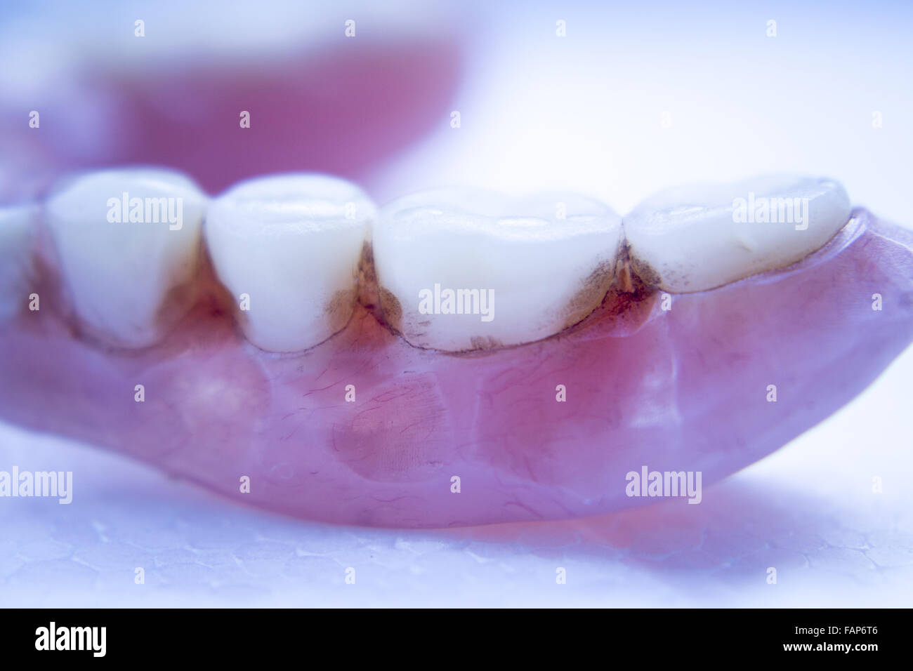 Removable partial denture metal and plastic dental false teeth ...
