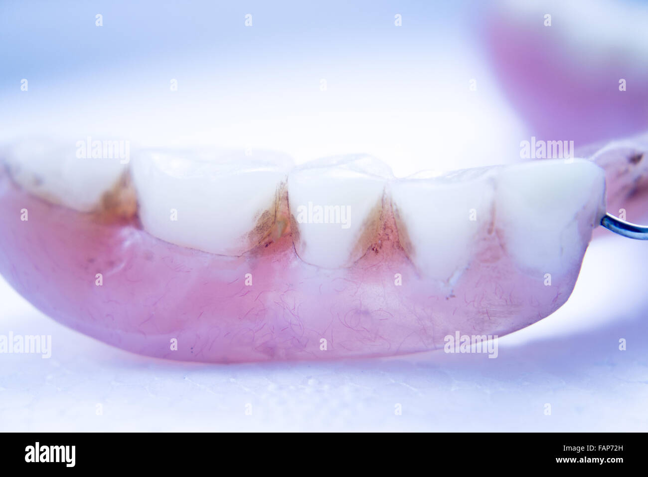 Removable partial denture metal and plastic dental false teeth ...