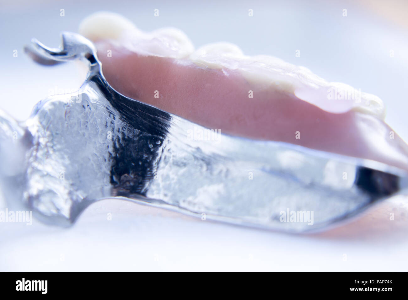 Removable partial denture metal and plastic dental false teeth ...