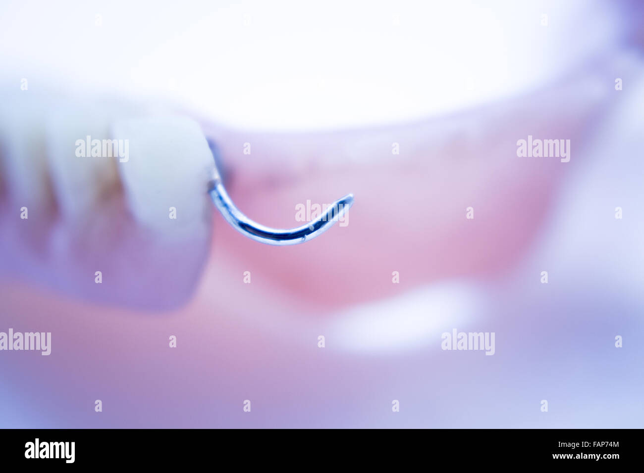 Removable partial denture metal and plastic dental false teeth ...