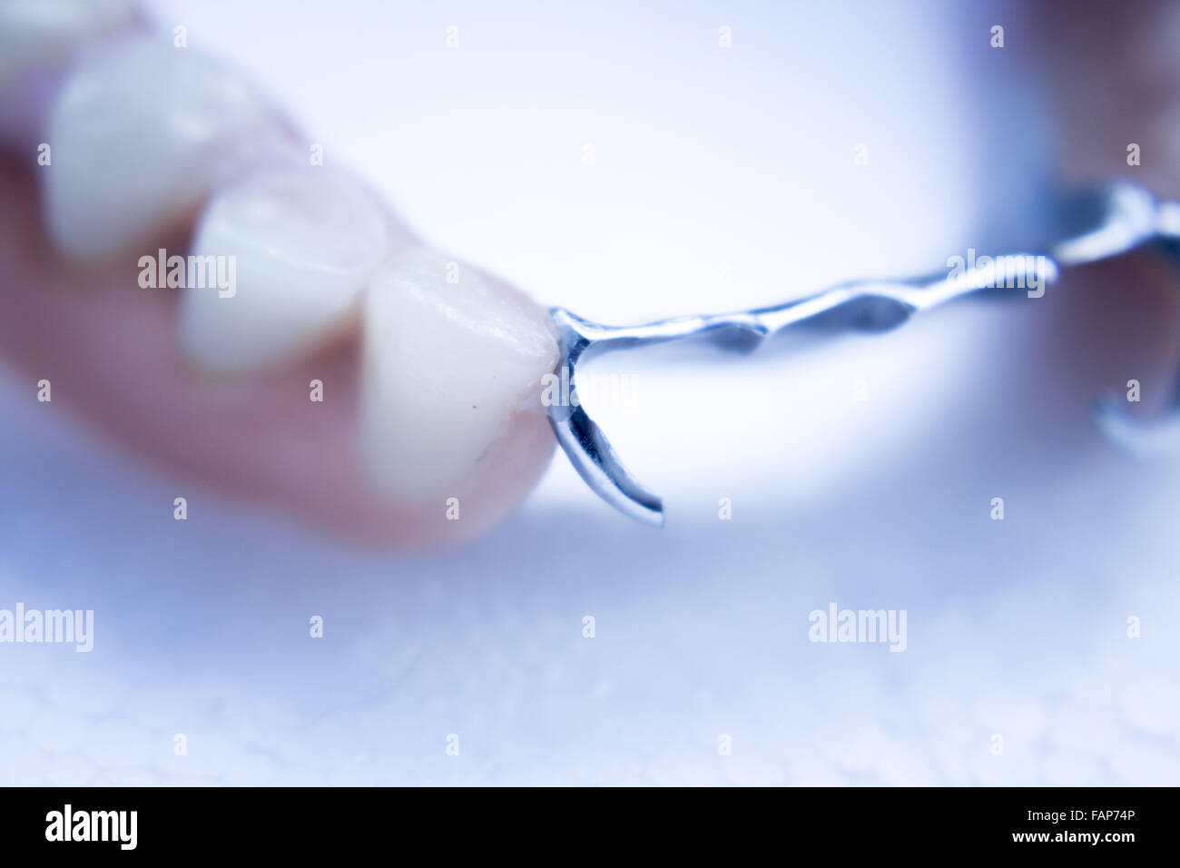 Removable partial denture metal and plastic dental false teeth ...