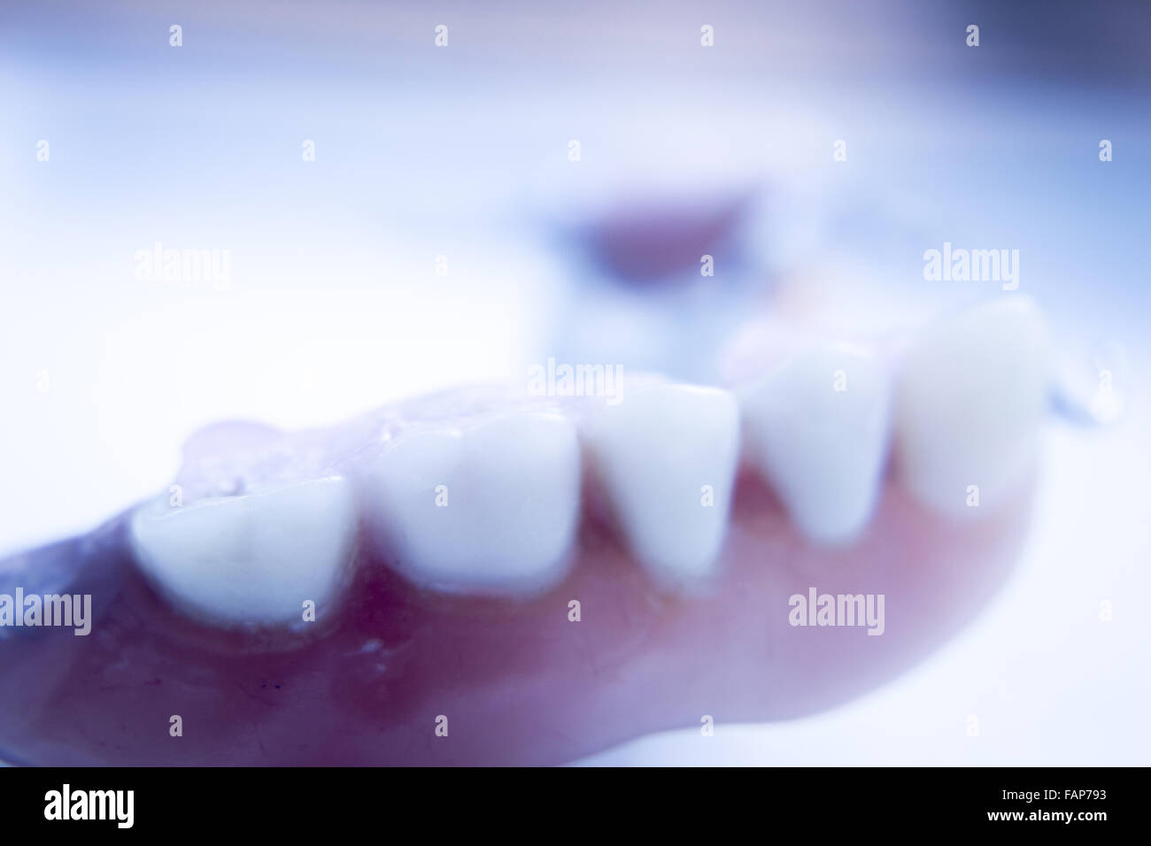 Removable partial denture metal and plastic dental false teeth ...