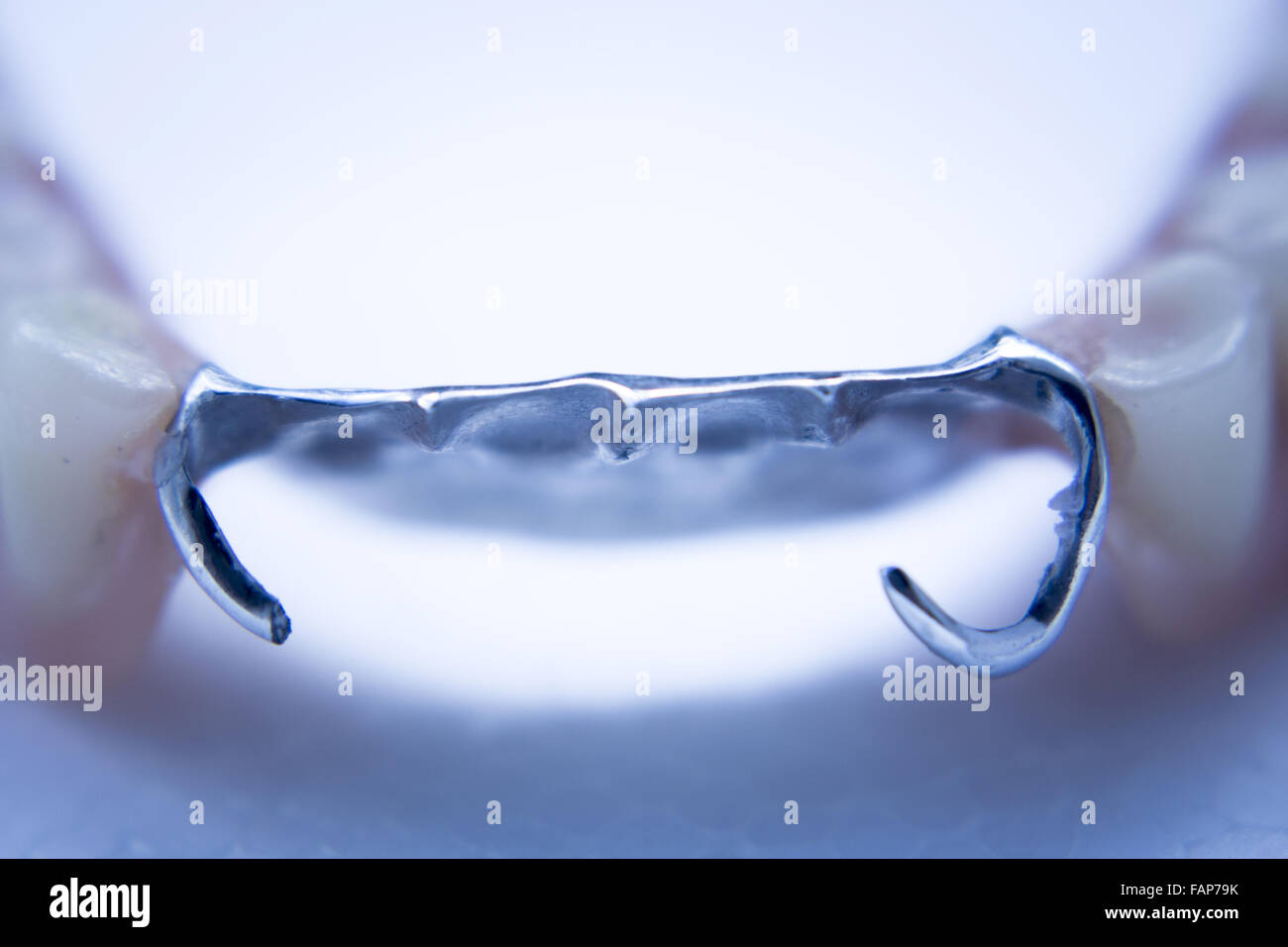 Removable partial denture metal and plastic dental false teeth ...