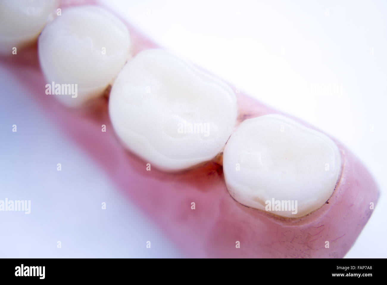 Removable partial denture metal and plastic dental false teeth ...