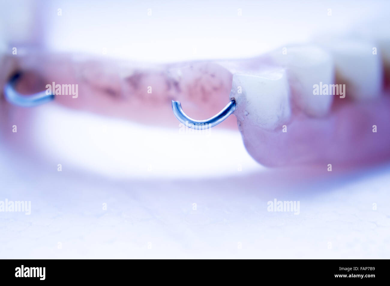 Removable partial denture metal and plastic dental false teeth ...